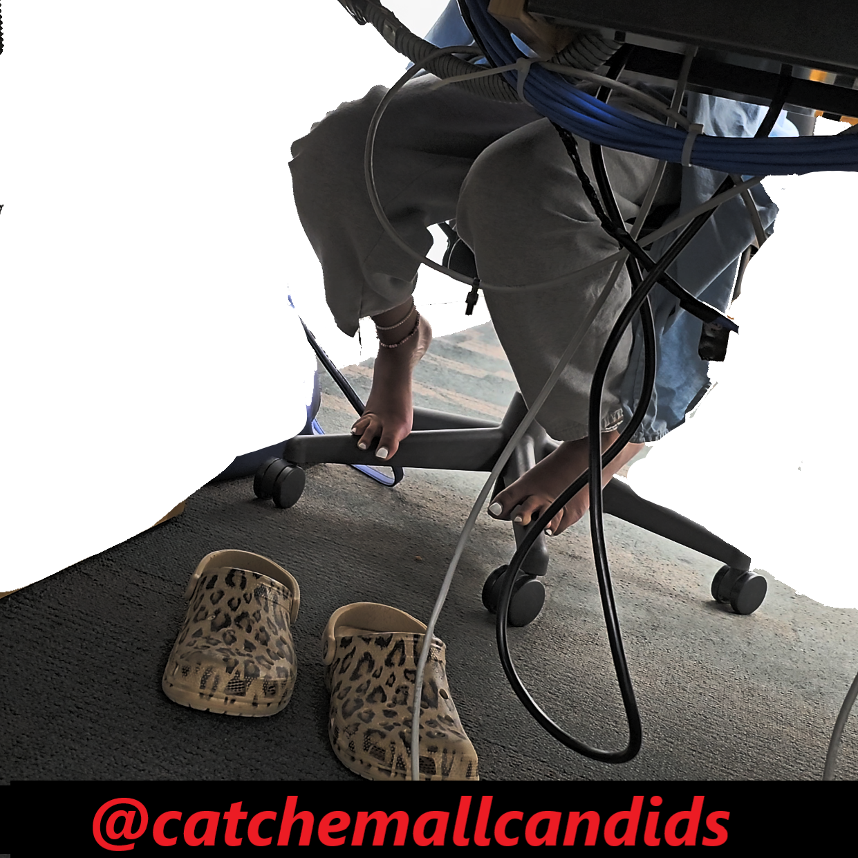 Ebony White Toes out of Leopard Crocs Day 1